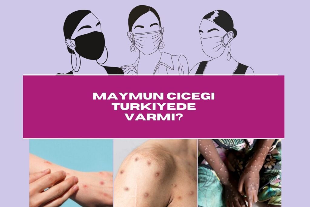 Maymun Cicegi Turkiyede Varmi? 15 Ağustos 2024 Güncel Durum